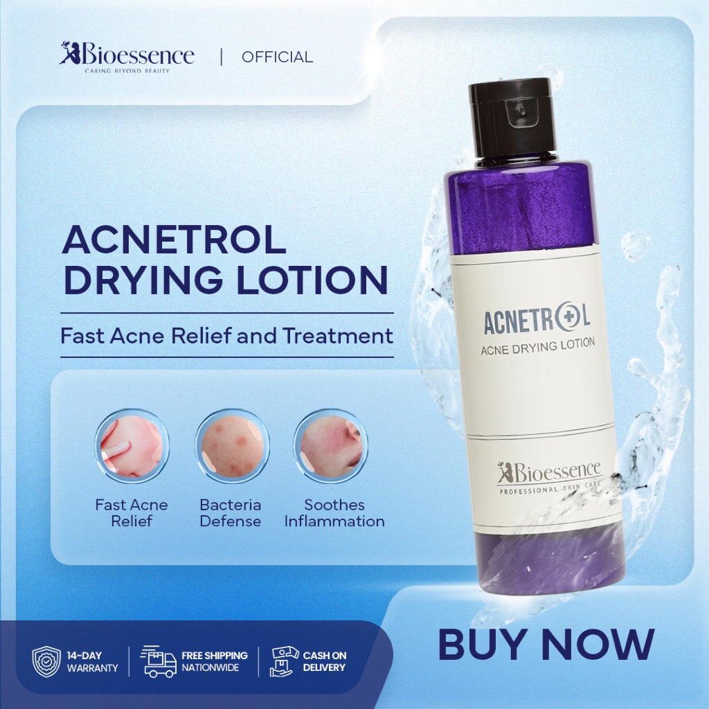 Acnetrol Acne Drying Lotion | Shopee Philippines
