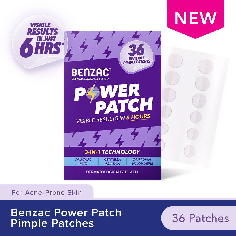[NEW] Benzac 3-in-1 Power Patch - 12 patches x 3 Sheets (Anti Acne ...