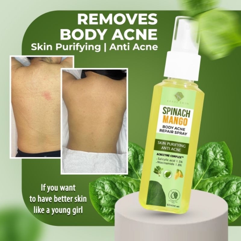 BODY ACNE SPRAY SPINACH MANGO body acne spray anti acne back spray ...