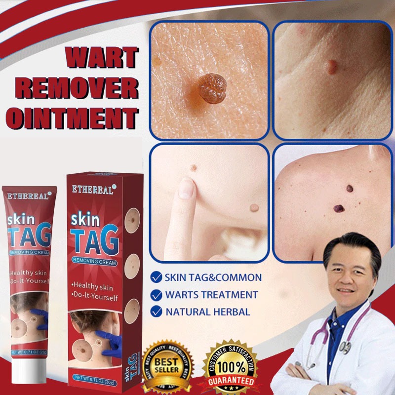 Wart Mole Skin Tag Remover Cream plantar wart remover 20g | Shopee ...