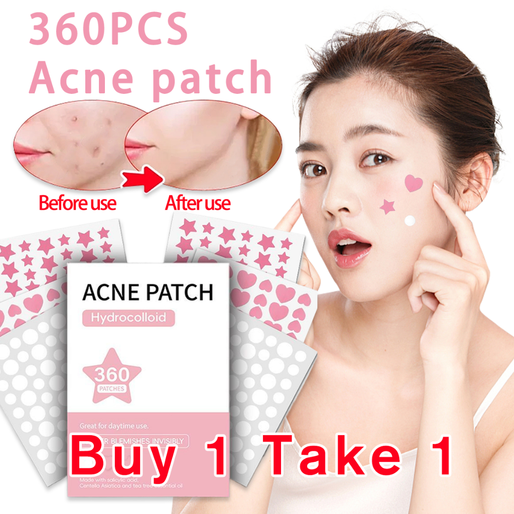 360pcs Hydrocolloid Colorful Acne Patch Mild Acne Pimples Patches ...
