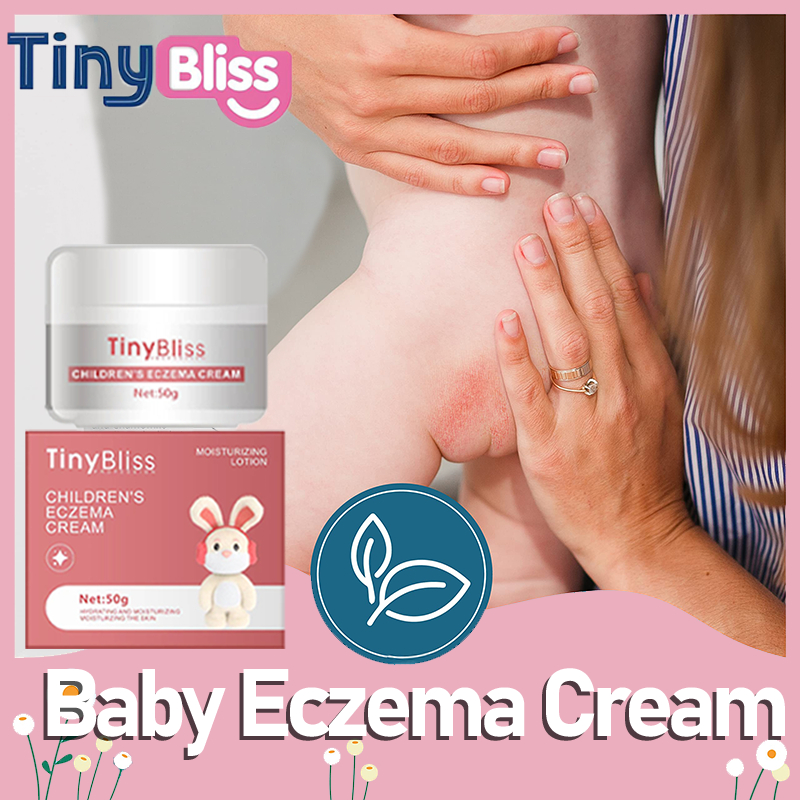 TinyBliss Baby Eczema Cream 50g Rashes Cream For Baby Applies to Eczema ...