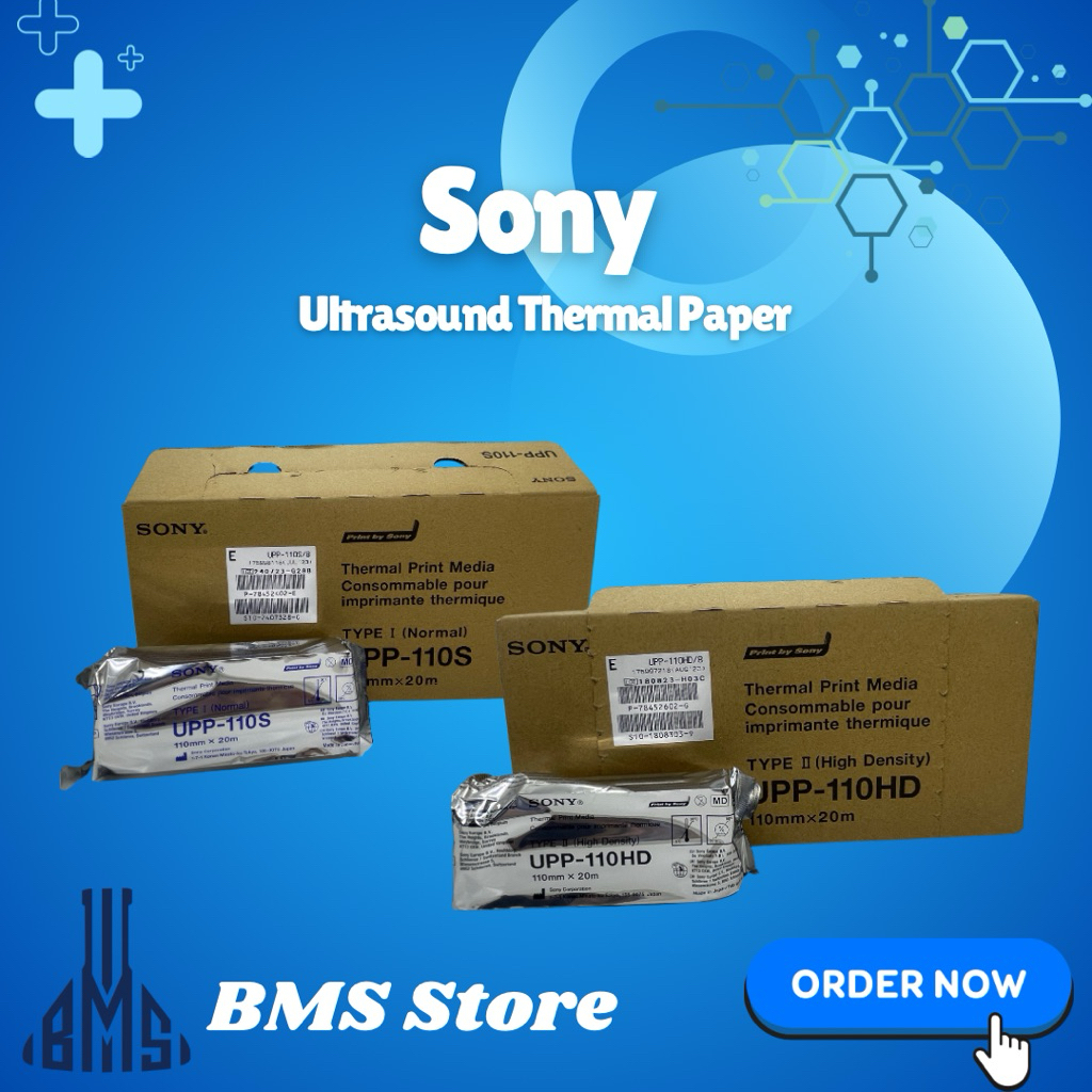 Sony Ultrasound Thermal Paper | Shopee Philippines