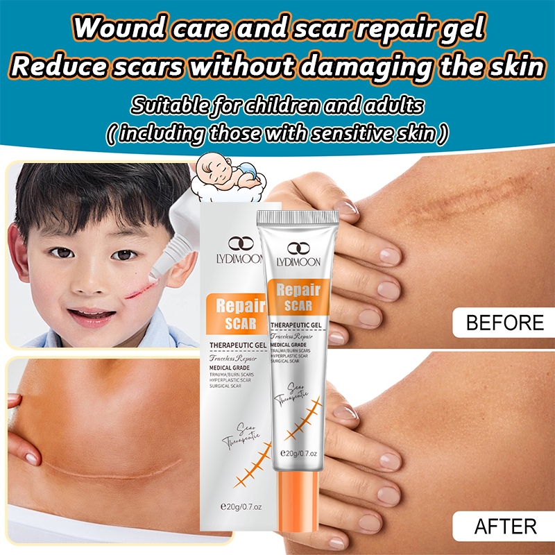 Wound care and scar repair gel Reduce scars without damaging the skin ...