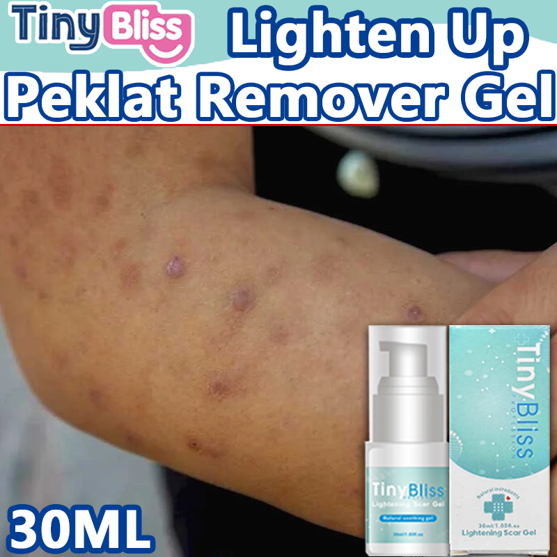 30ML TinyBliss Scars Remover Peklat Remover Original Scar Gel Removal ...
