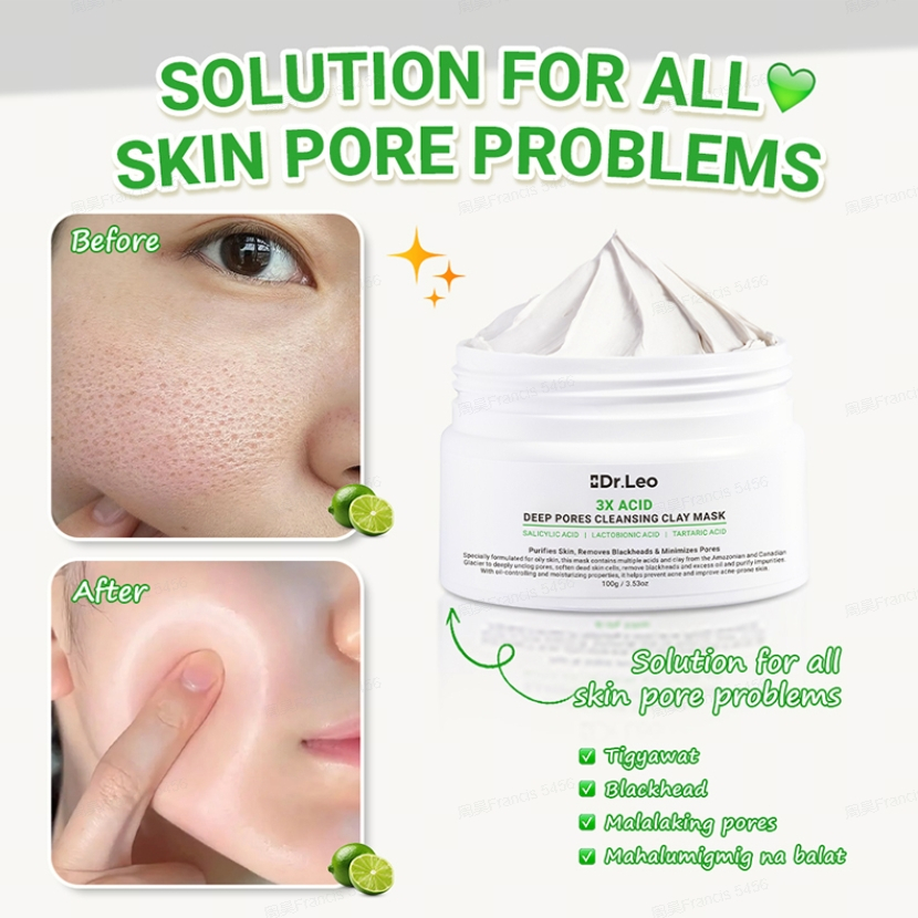 Dr Leo 3X Cleansing clay Mask Black Heads Removel Purifying Salicylic ...