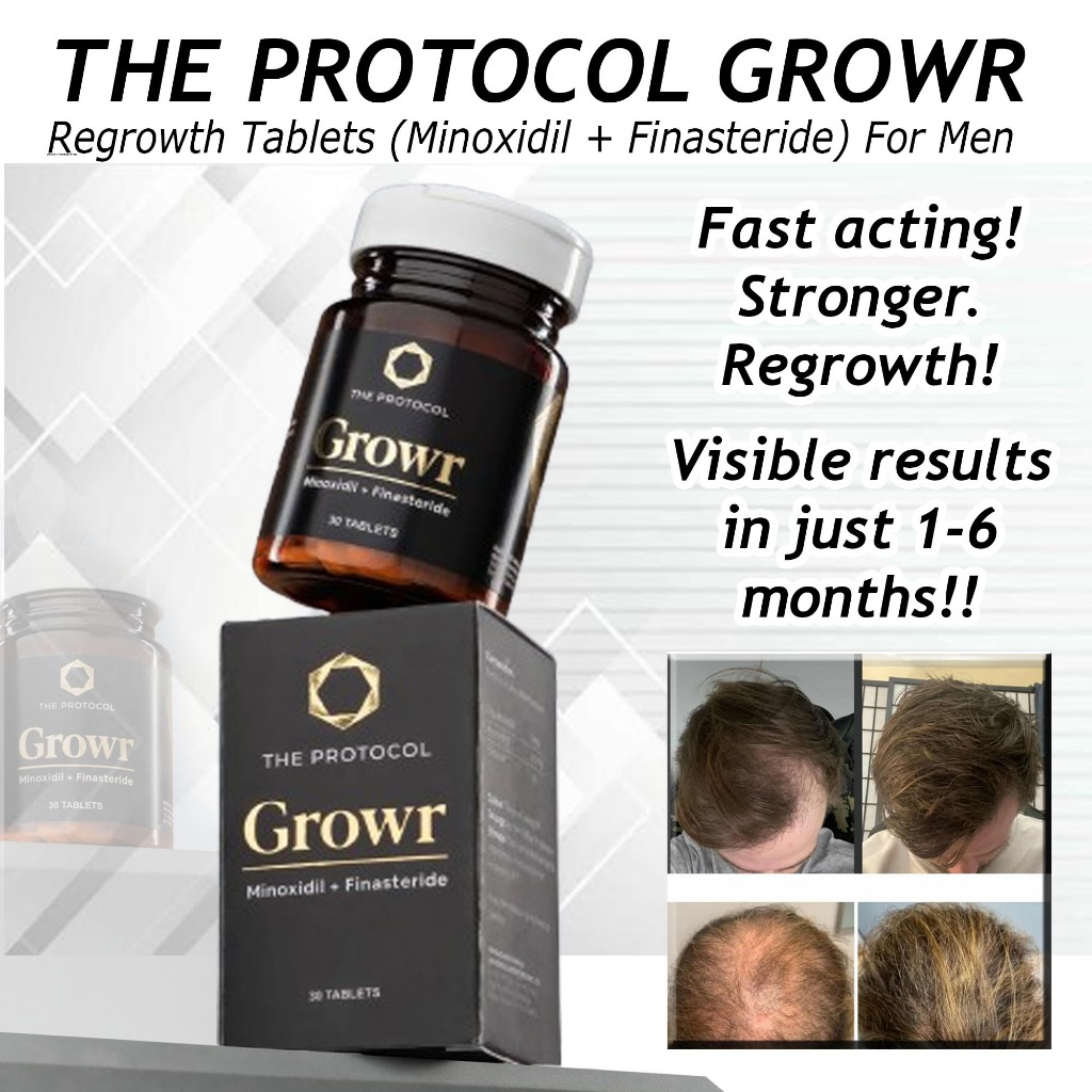 The protocol Hair Growr - hair grower | Shopee Philippines