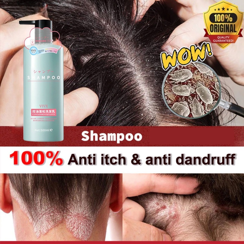Psoriasis Shampoo Anti Dandruff Shampoo Anti-itch shampoo 500ml For ...