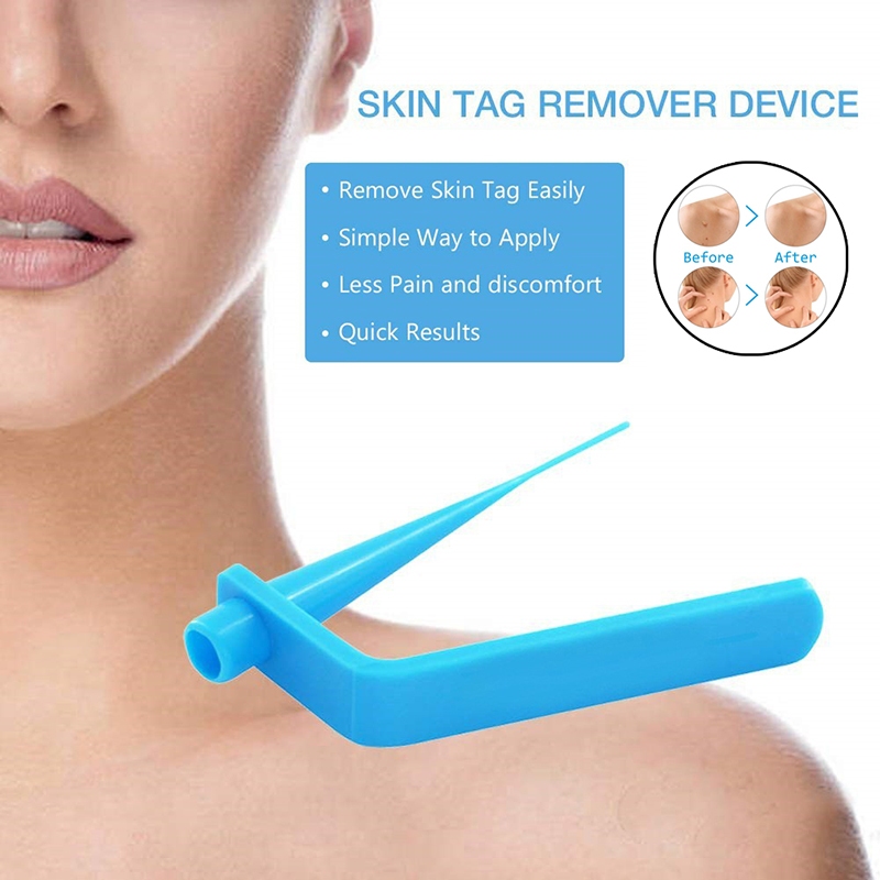 Skin Care Rubber Bands Skin Tag Remover Skin Tag Removal Kit Face Care ...
