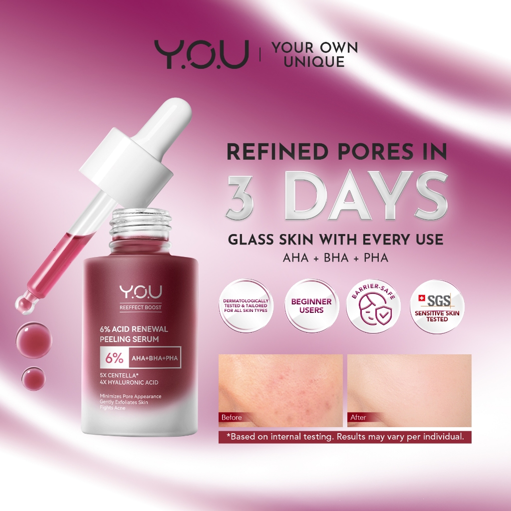 [BEST SELLING] YOU Reeffect Boost Acid Renewal Peeling Serum 6% / 12% ...