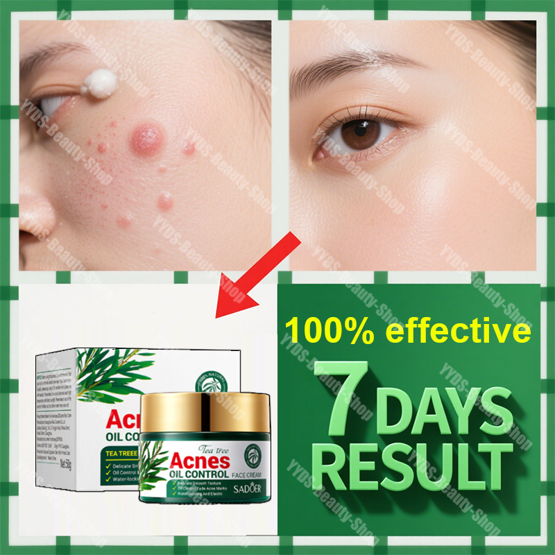 Pimple acne remover Pore Minimizer Oil Control & Lightweight ...