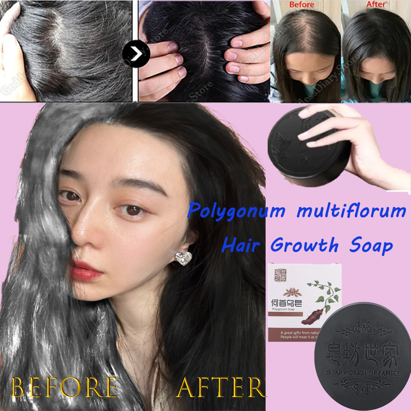 NG【BUY 1 TAKE 1】 GE Hair Growth Soap Ginseng Polygonum Soap Hair Grower ...
