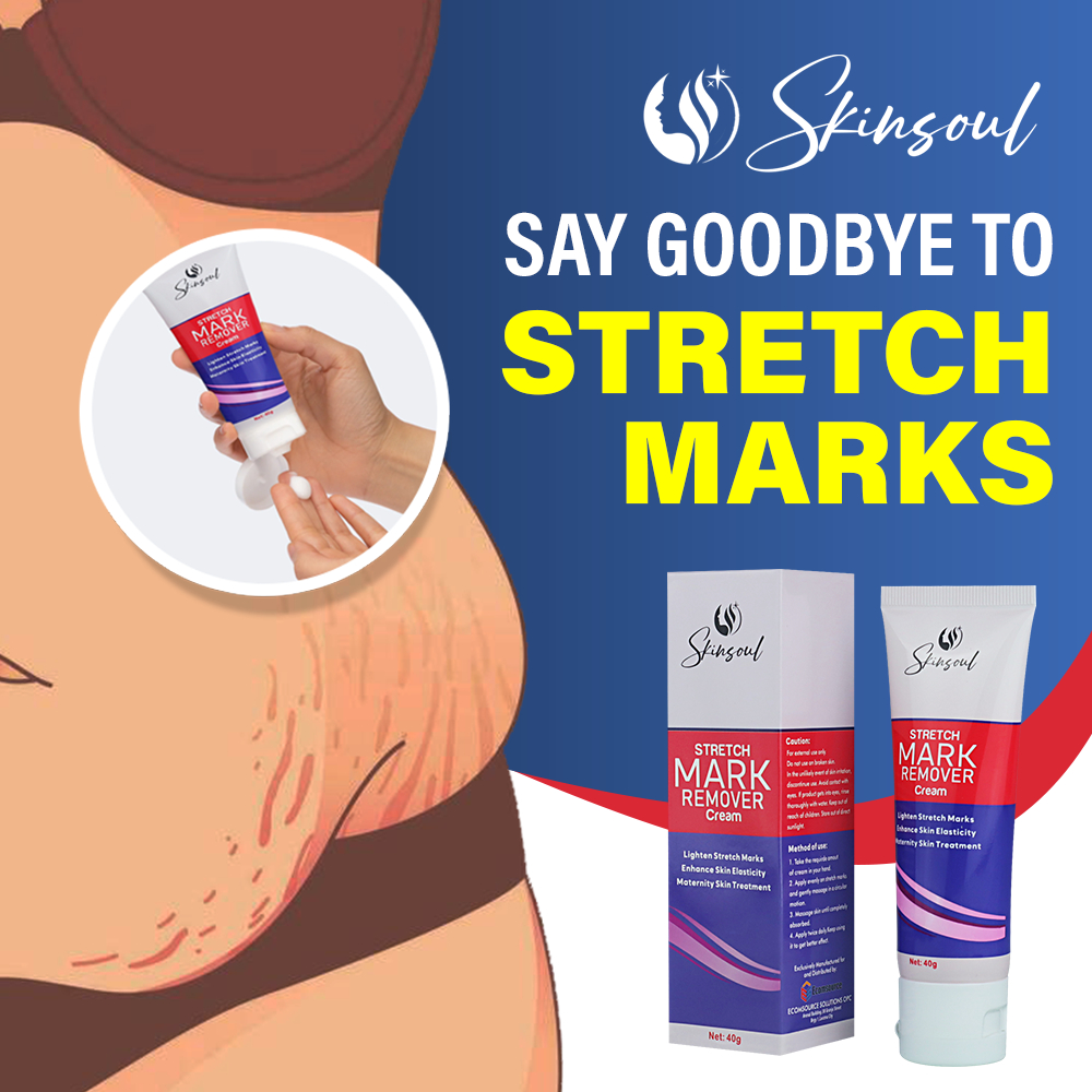 Skinsoul Stretch Mark Remover Anti Stretch Mark Cream Removal | Shopee ...