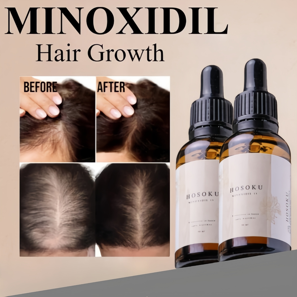 Minoxidil Hosoku Hair Growth (With Collagen And Castor Oil) Hair Grower ...