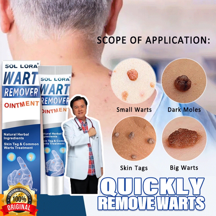 Warts Remover Original Cream Kulugo Skin Tags Mole Remover Warts ...