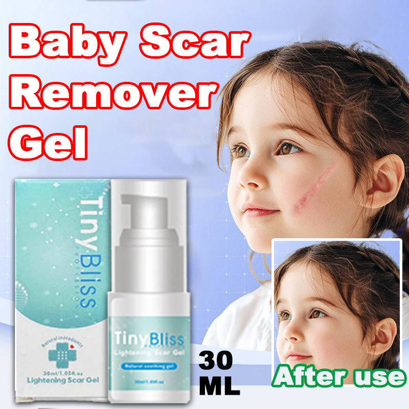TinyBliss Baby Scar Remover Gel Baby Scar Gel Baby lightening scar gel ...