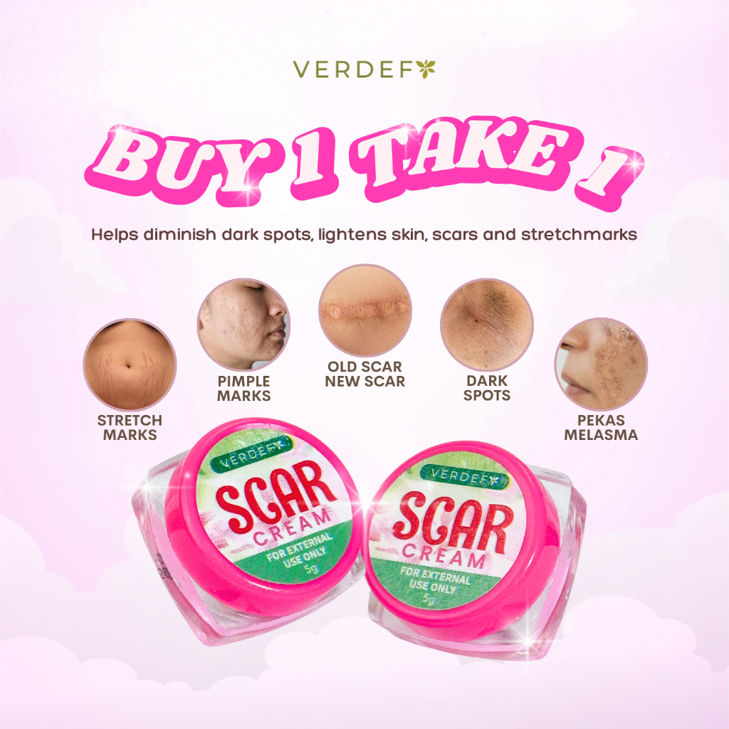[BUY 1 TAKE 1] VERDEFY Scar Cream 5g - Helps Lighten Your Scars, Peklat ...