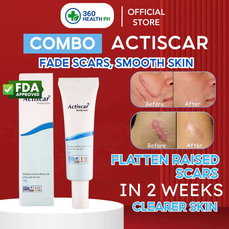 [BUY 1 GET 1] Actiscar Professional Scar Serum: Fades Pitted, Deep ...