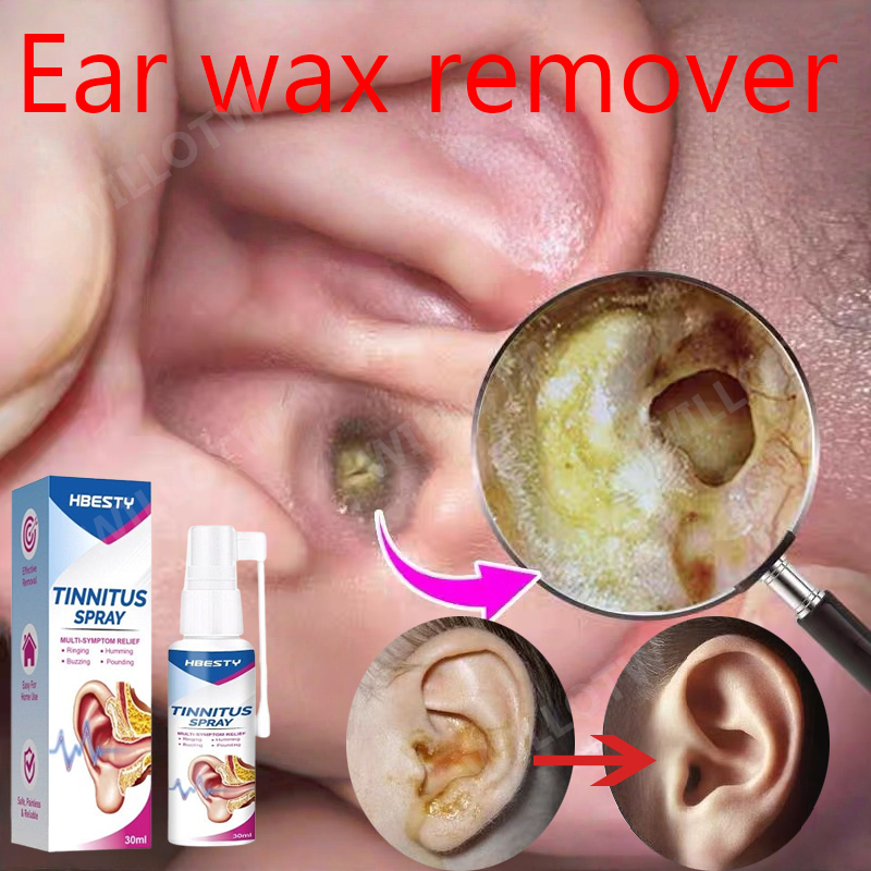 Ear drops for human ear infection Earwax removal Tinnitus ear drops ...