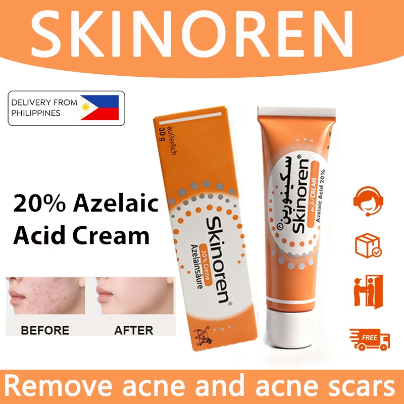 Skinoren Azelaic Acid 20% Cream Acne Removal And Pimples&Make Up Acne ...