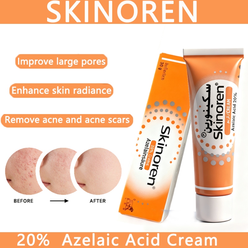 Skinoren Authentic Azelaic Acid 20% Acne Treatment Cream 30g | Shopee ...