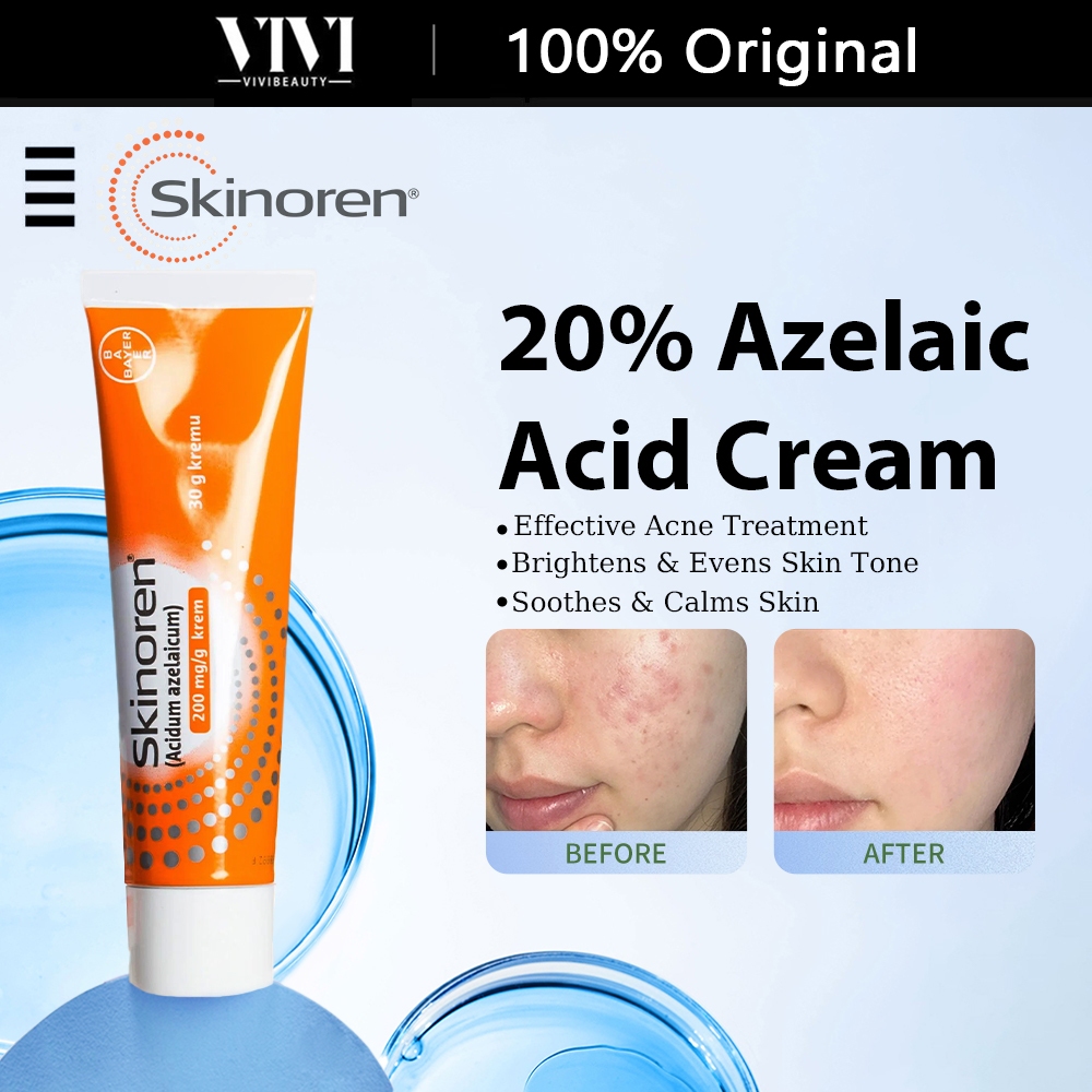 Skinoren Azelaic Acid 20% Cream Acne Removal And Pimples&Make Up Acne ...