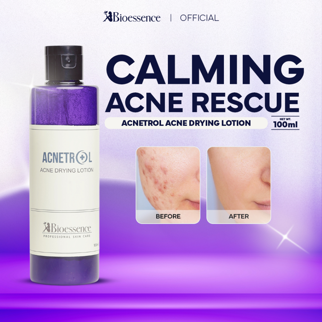 Bioessence Acnetrol Drying Lotion 100ml – Calming Acne Rescue | Shopee ...