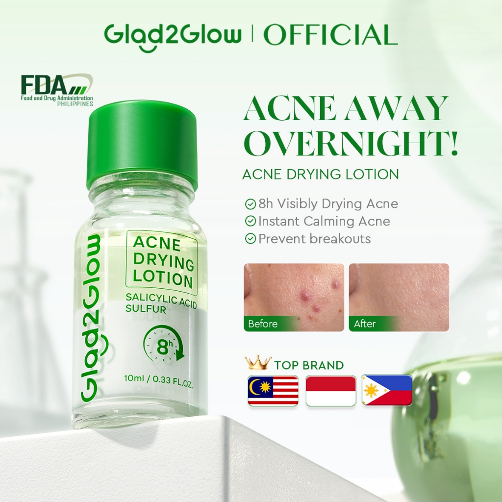 [8 Hours pimple Treatment] Glad2Glow Acne Drying Care Serum 10 ml Scar ...