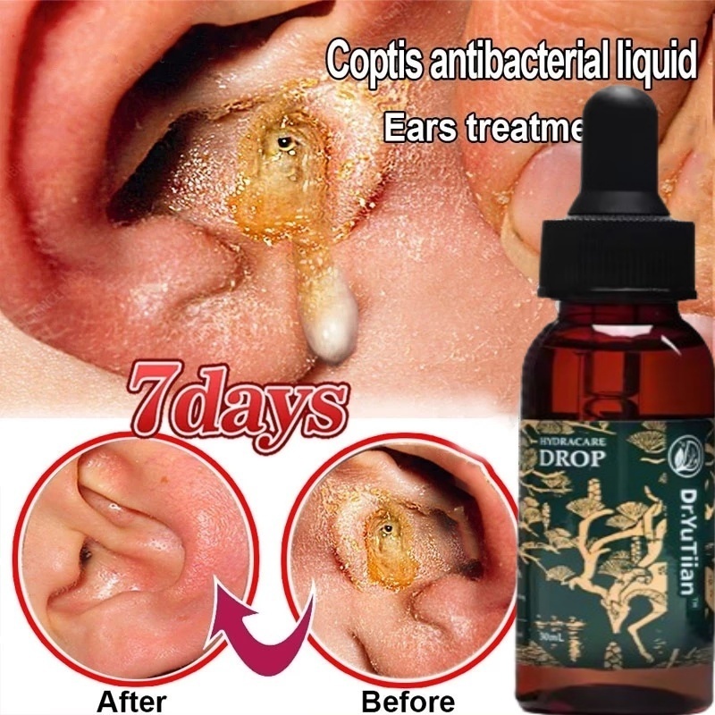 Natural Herbal Ear Drops 30ml Tinnitus Relief and Earache Treatment for ...