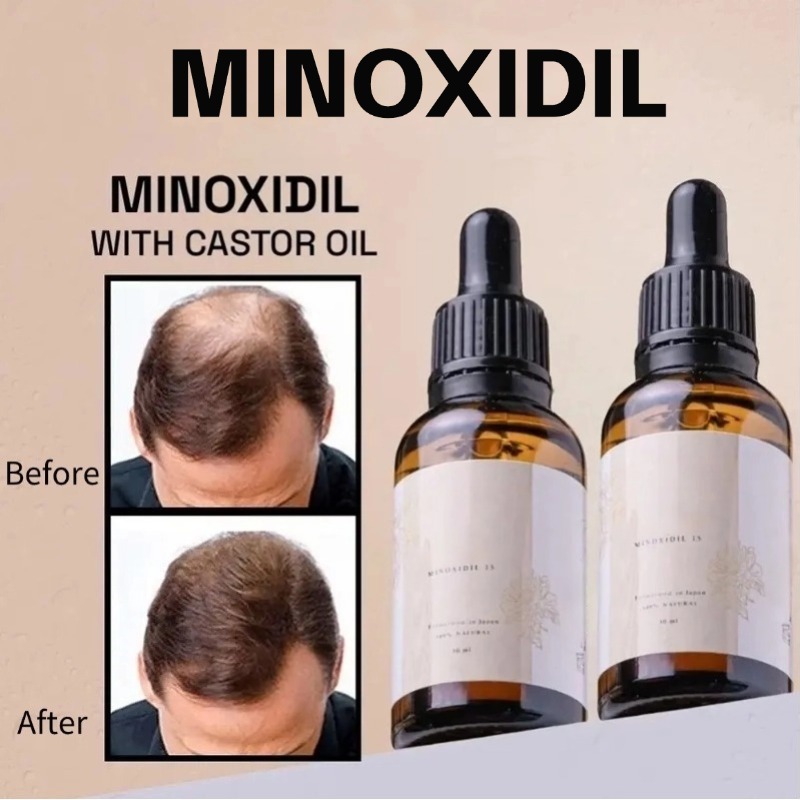 Minoxidil Hair Growth Treatment with Collagen and Essential Oil Hair ...