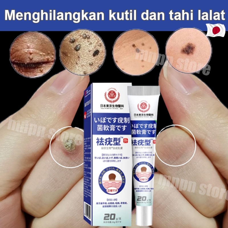 Japan warts remover original mole skin tag remover genital warts ...