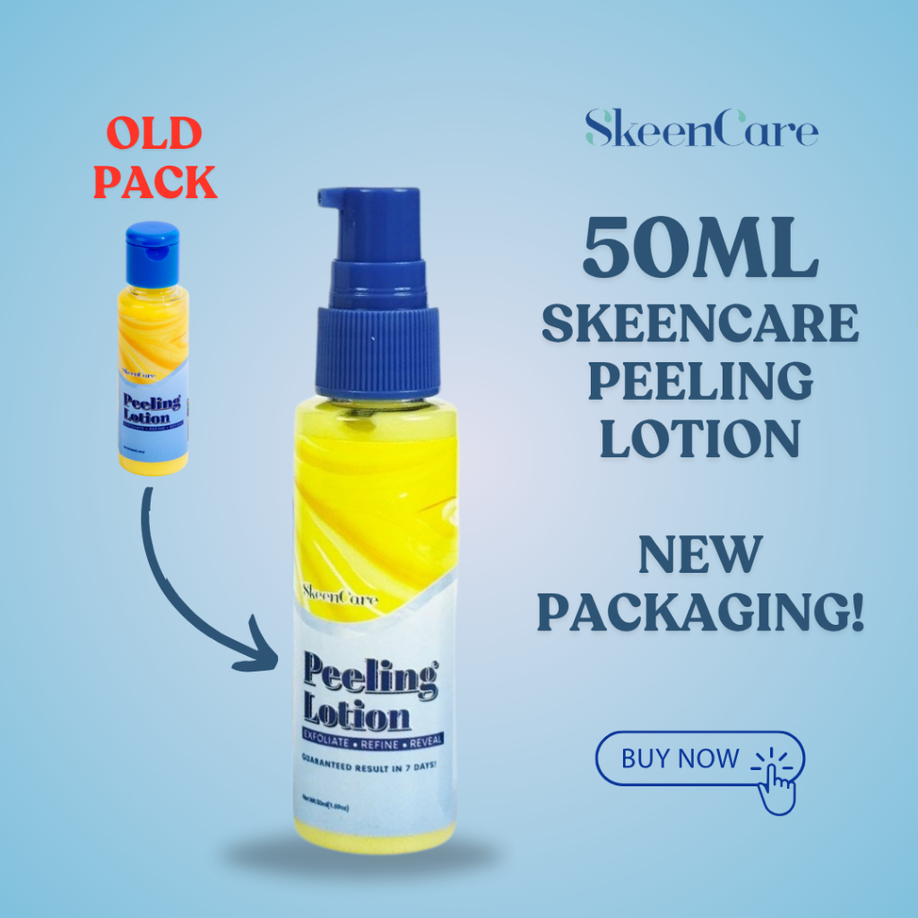 Peeling Lotion Extra Strength Original New Bottle Pump | Shopee Philippines