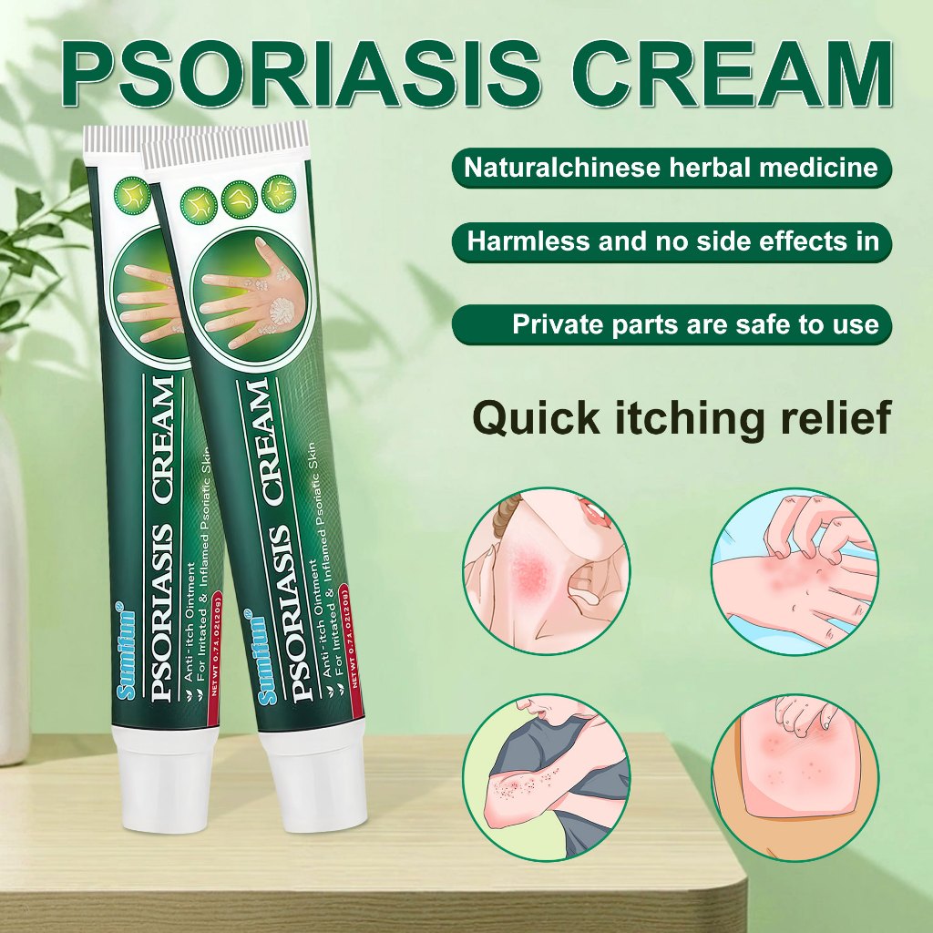 Eczema Treatment Antibacterial Cream Anti Fungal Anti Itch Sweat Herpes ...