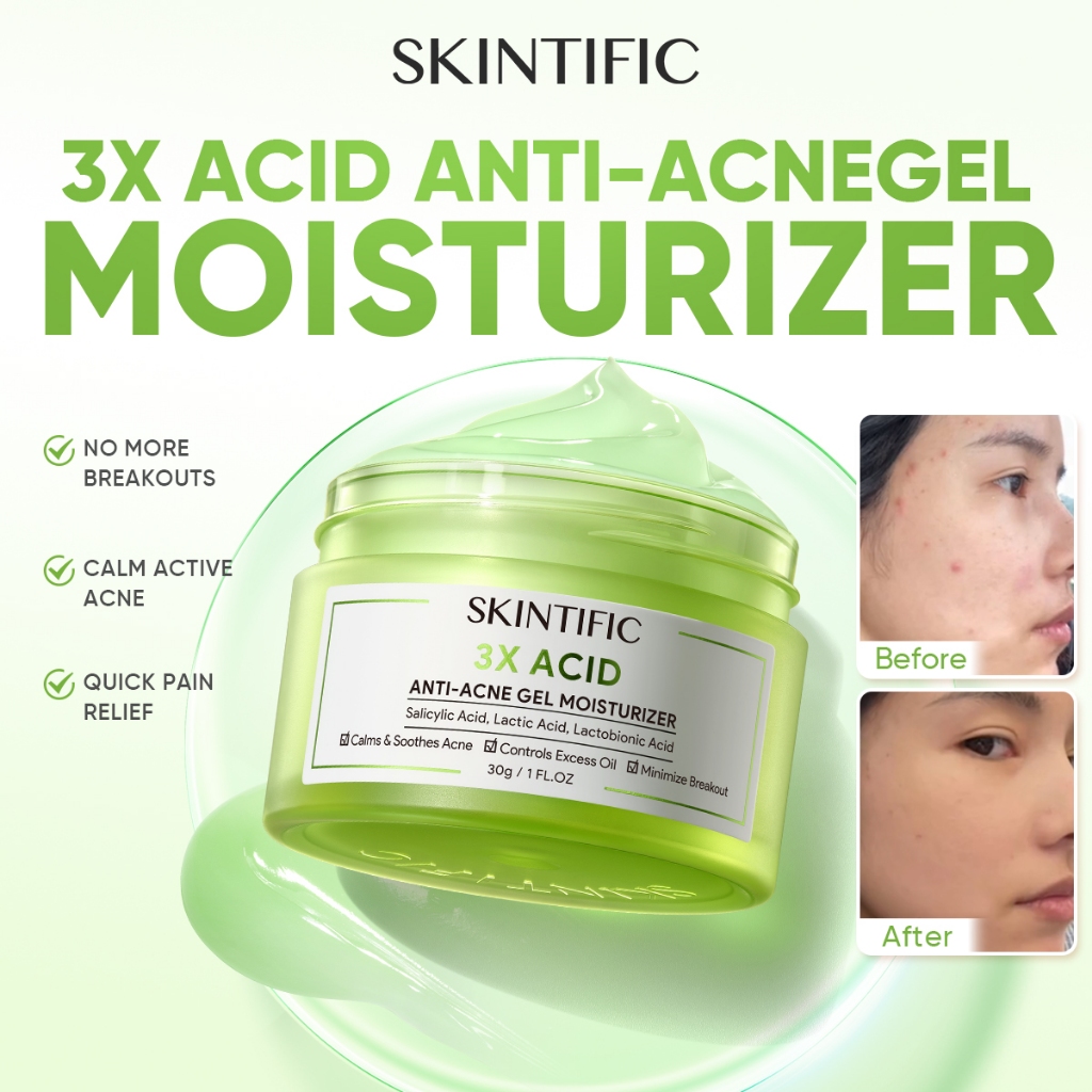 [New Launch] SKINTIFIC 3X ACID Anti-Acne Pore Black Head Removal Gel ...
