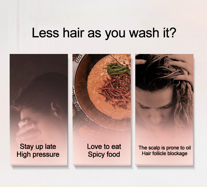AZLA Ginger Hair Shampoo Fast Regrowth Anti-Hair Loss Anti-Dandruff ...