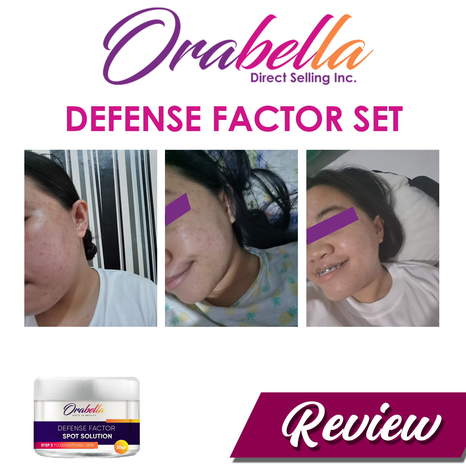 Orabella Defense Factor System Set Of 5 Products Anti Acne All Natural ...