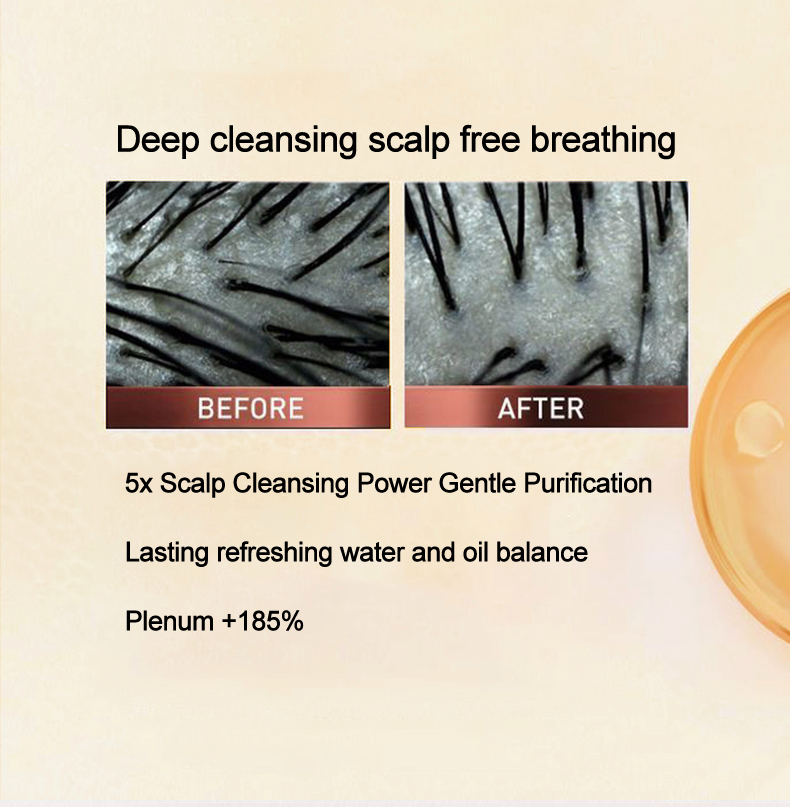 AZLA Ginger Hair Shampoo Fast Regrowth Anti-Hair Loss Anti-Dandruff ...