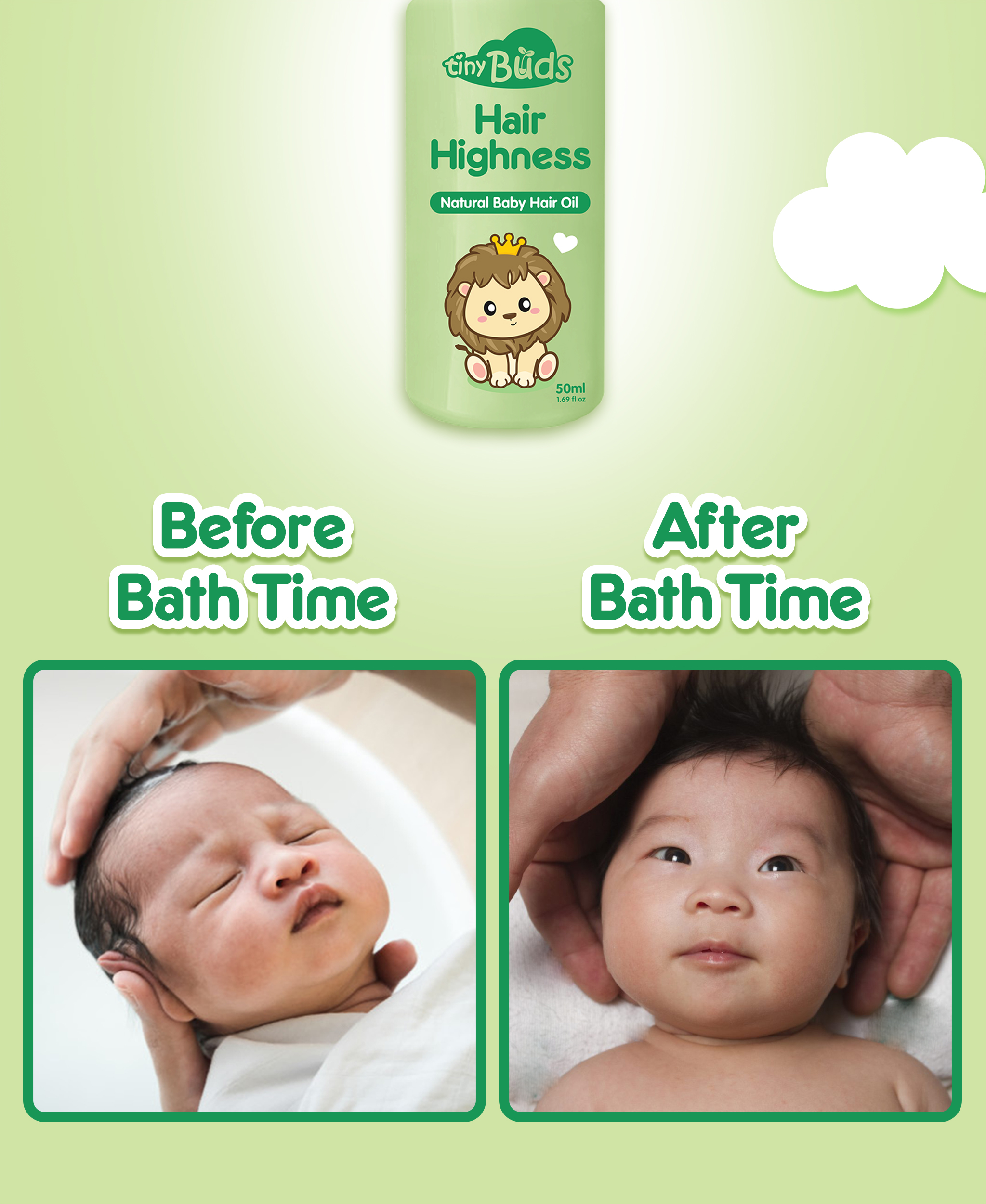 Tiny Buds Hair Highness Natural Baby Hair Oil [FS] | Shopee Philippines