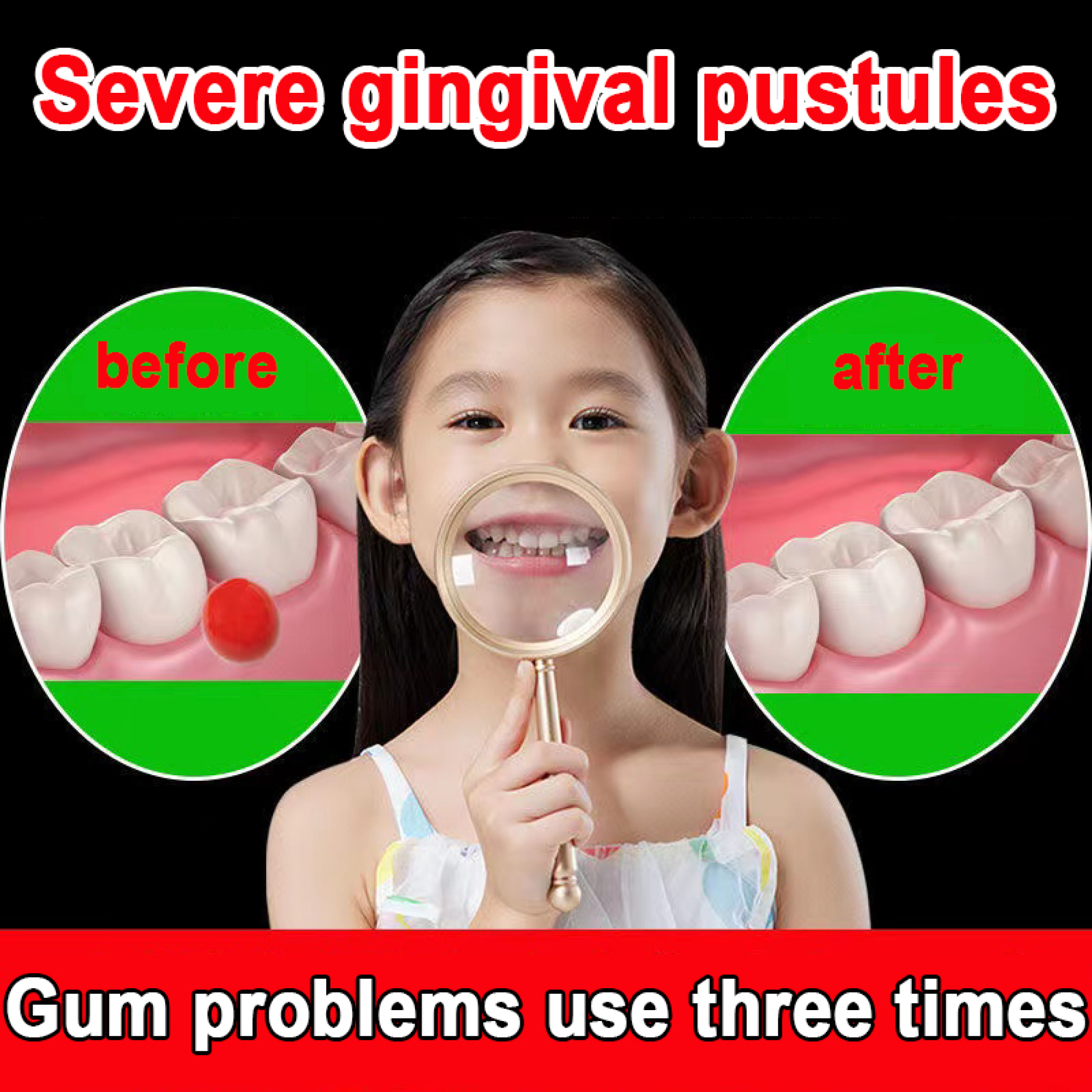 Toothache Spray Fast Pain Relief for adults & kids Periodontitis Tooth ...