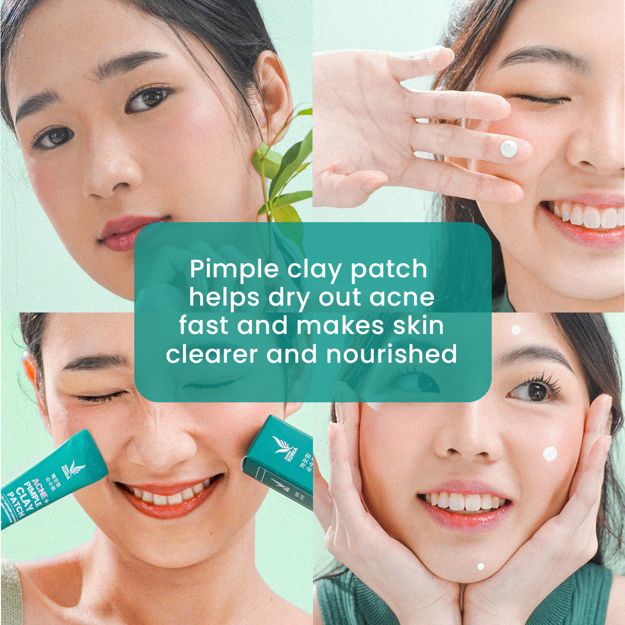 iWhite Korea Acne+ Pimple Clay Patch Tube 15ml | Shopee Philippines