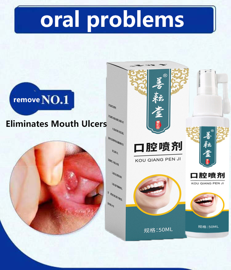 Canker sore spray 50ml mouth ulcer treatment Canker mouth sore solution ...