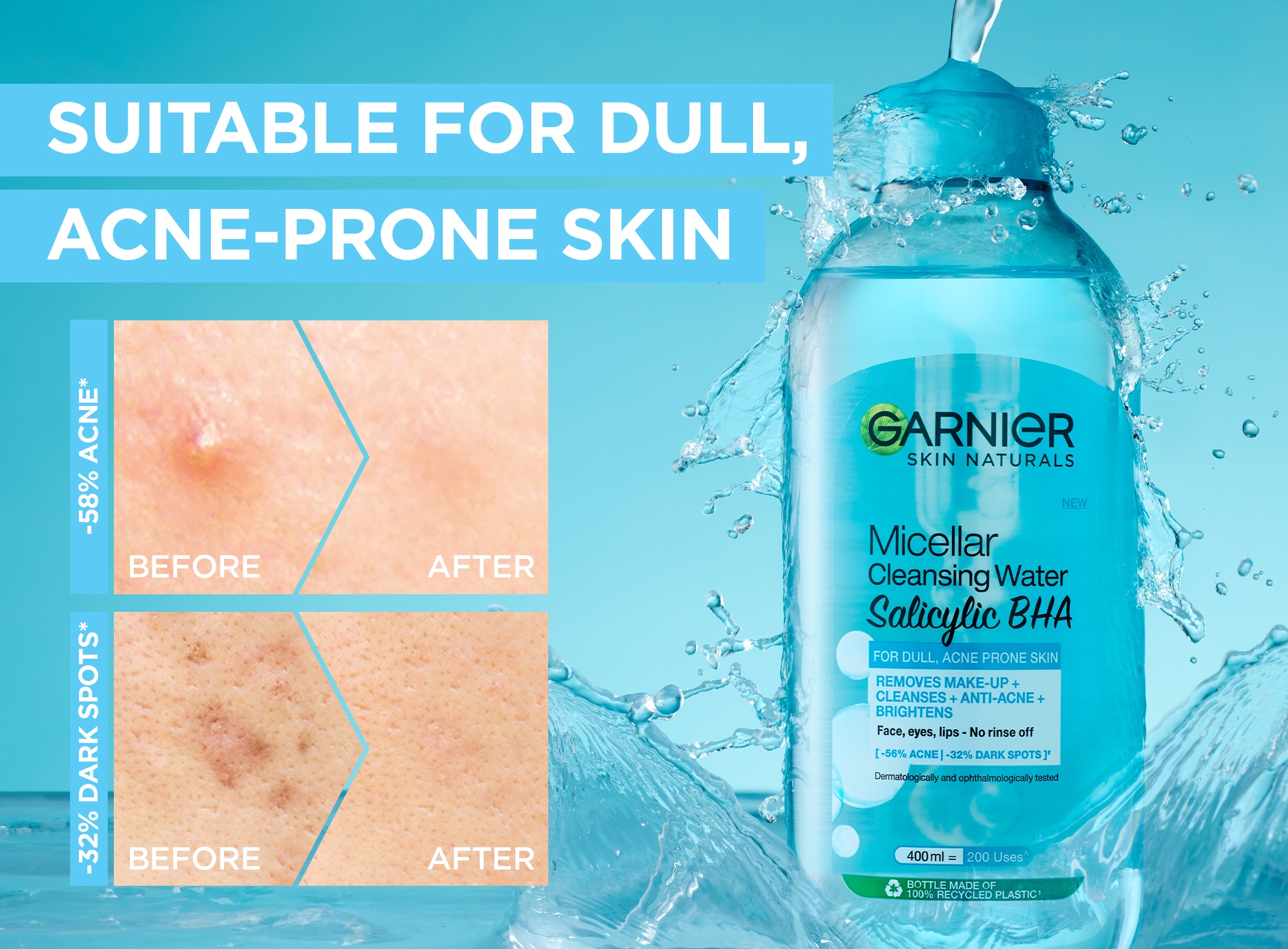 Garnier Anti Acne Salicylic Acid Micellar Water Makeup Remover, Facial ...
