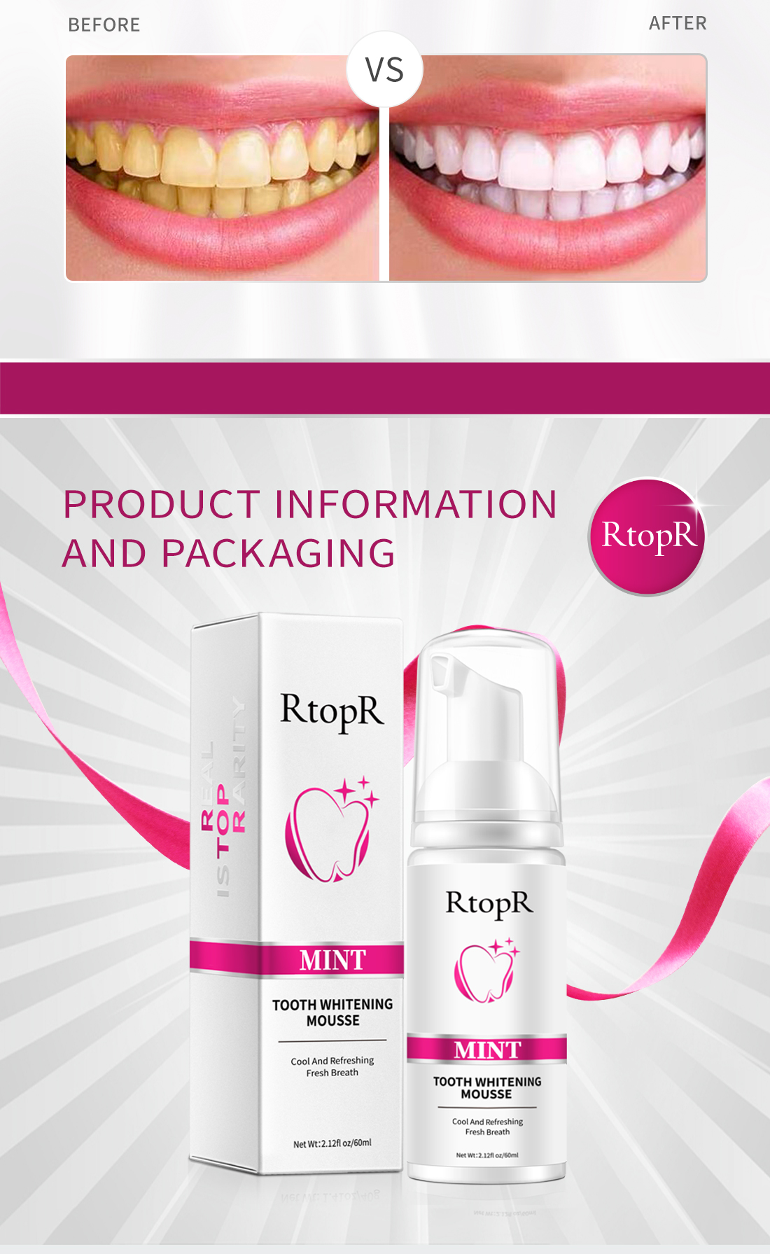 RtopR Teeth Whitening Mousse Remove Tartar Plaque Teeth Cleaning ...