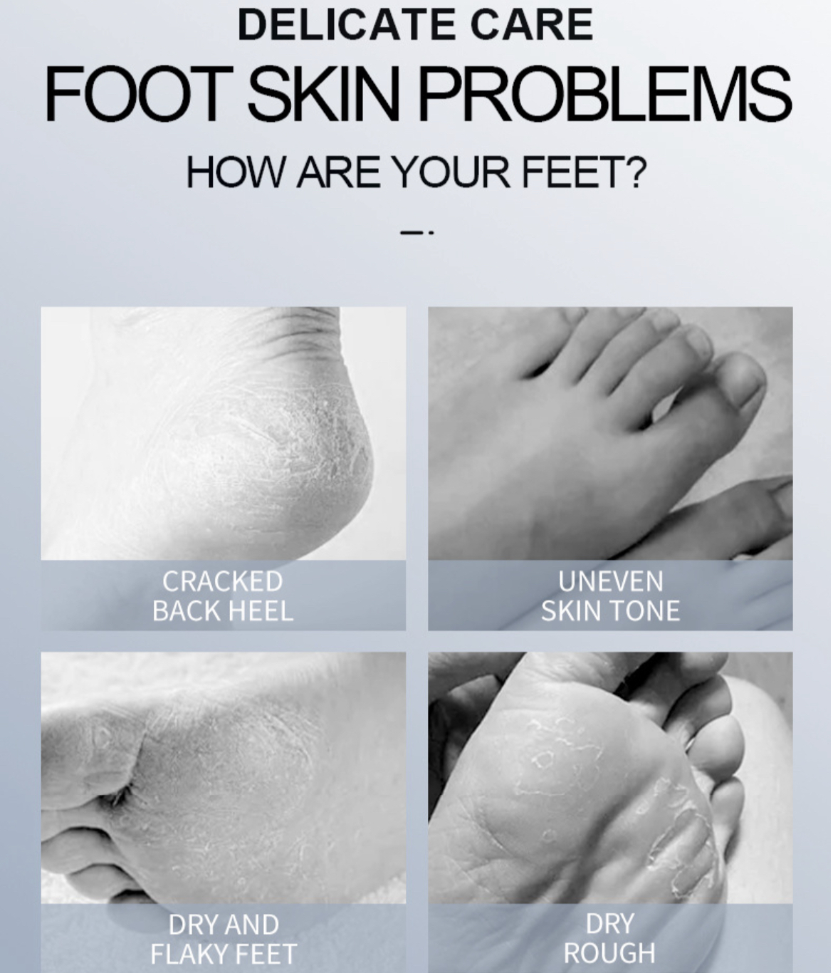 abbott SADOER foot mask skin rejuvenation, plant whitening | Shopee ...