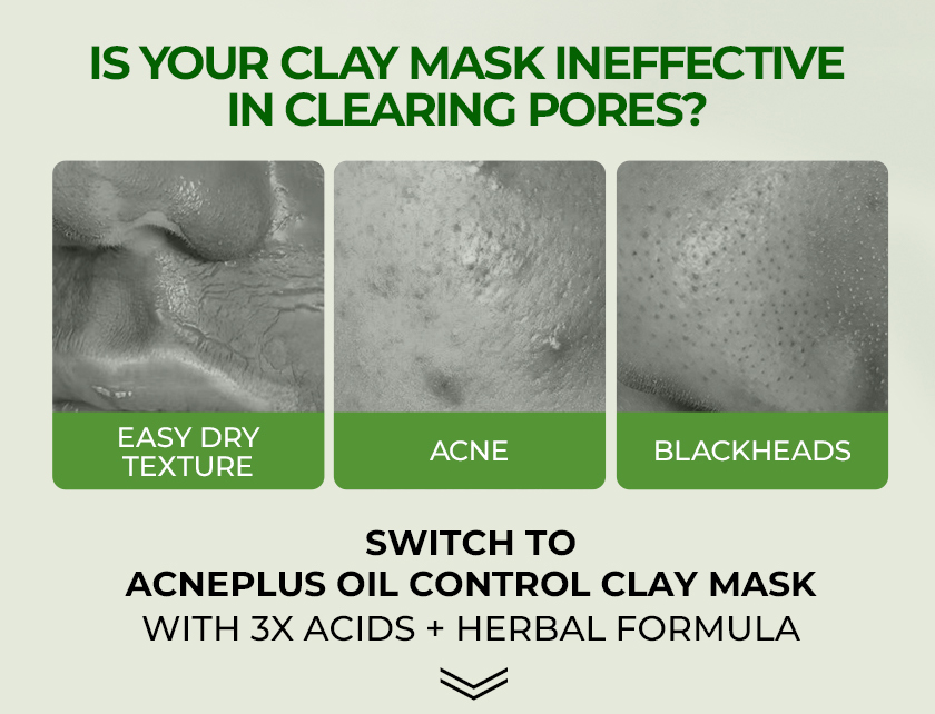 Y.O.U AcnePlus Oil Control Clay Mask | Amazonian Clay | Remove ...
