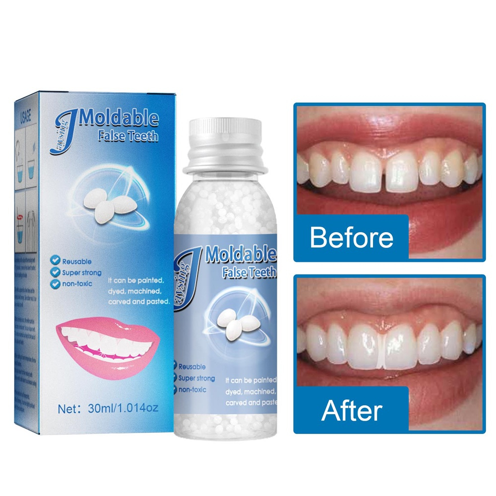 『BUY 1 TAKE 1』30ML Temporary Tooth Repair Kit Teeth and Gaps Moldable ...