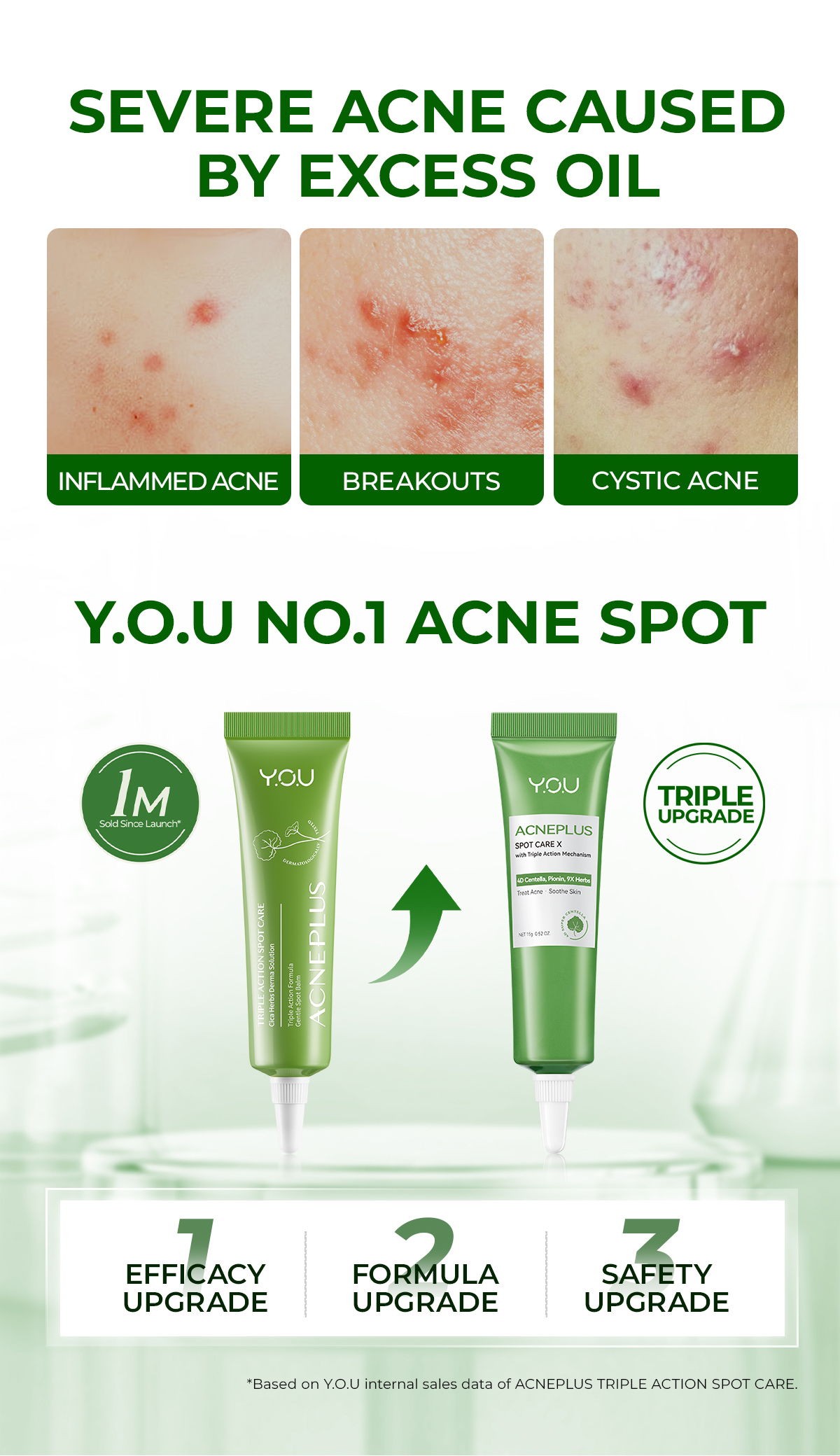 Y.O.U AcnePlus Triple Action Spot Care X 15g Duo | 4D Centella | Pionin ...