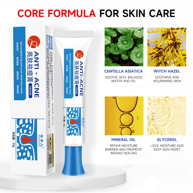 Acne Remover Cream Pimple Marks Remover Cream Treatment Acne Scar ...