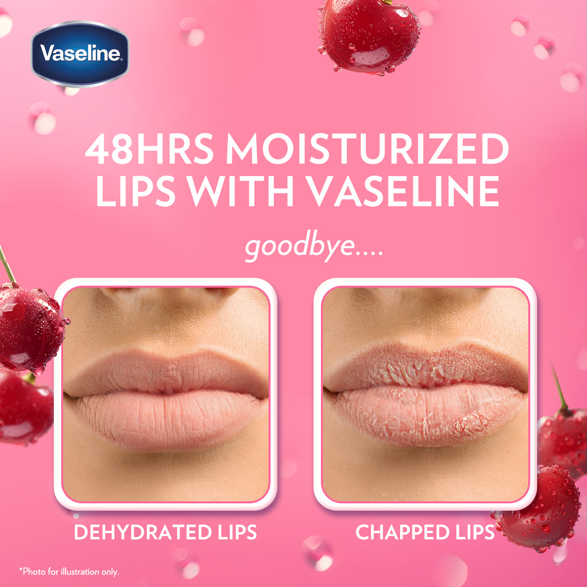 Vaseline Lip Cherry Blush Lip Balm Stick 4.8G | Shopee Philippines