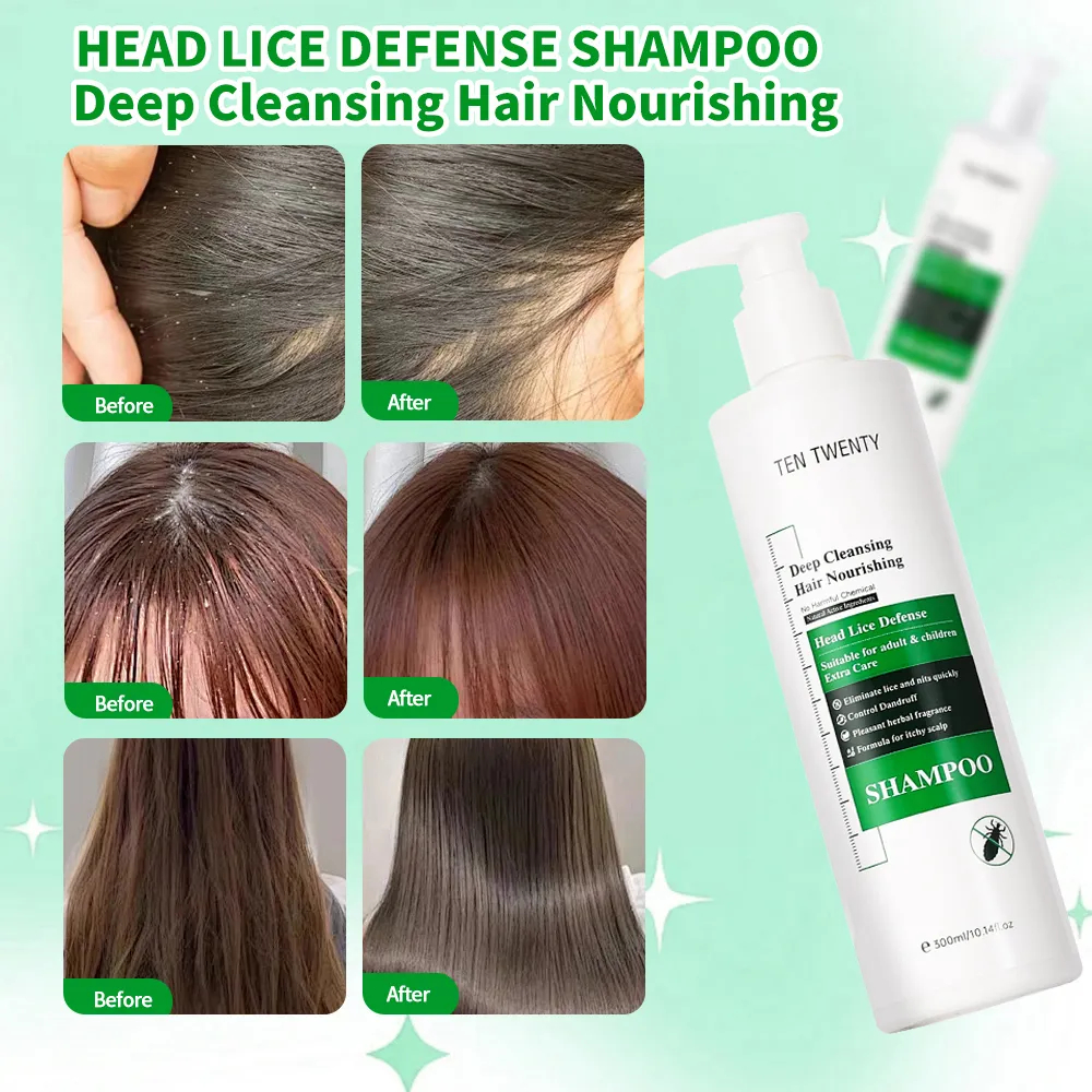 TEN TWENTY Deep Cleaning Shampoo – Head Lice Control & Anti-Dandruff ...